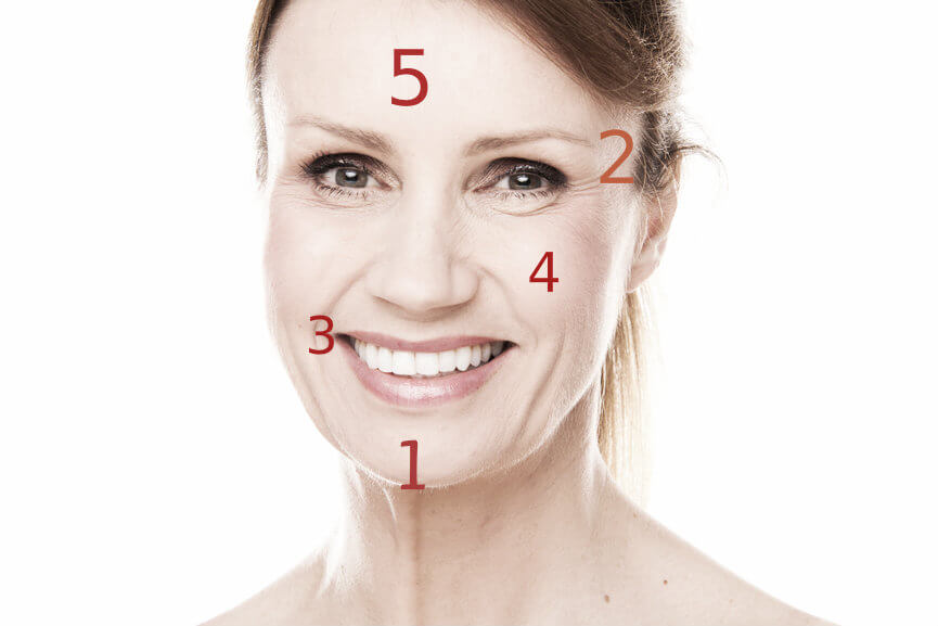 DIT is wat de plek van een pukkel zegt over je gezondheid, en zo ...