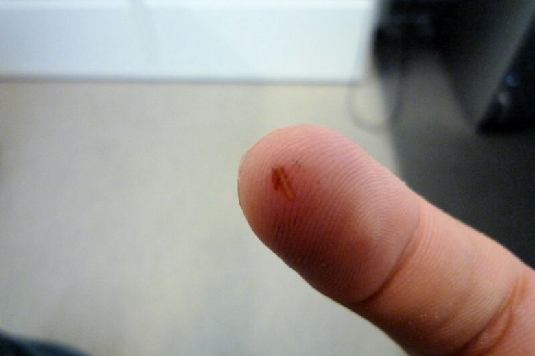 Handig: zo krijg je moeiteloos een splinter uit je huid