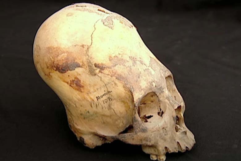 Wow! These weird beauty trends used to be all the rage